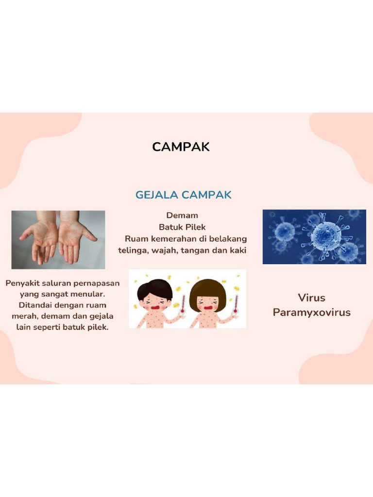 Leaflet Penyuluhan Campak | PDF