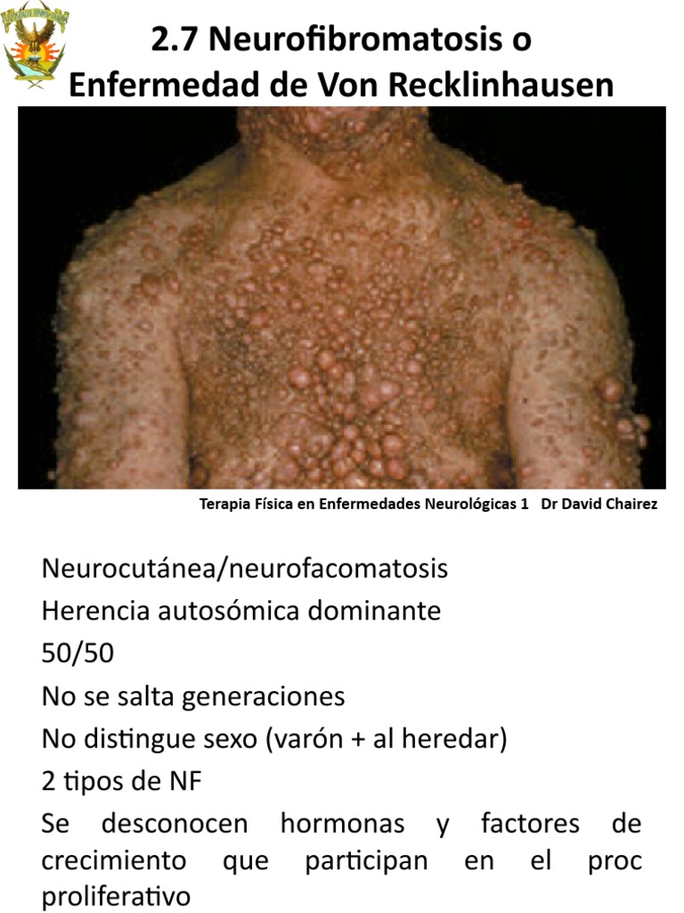 2.7 Enfermedad de Von Recklinhausen (Von Recklinhausen Disease) | PDF
