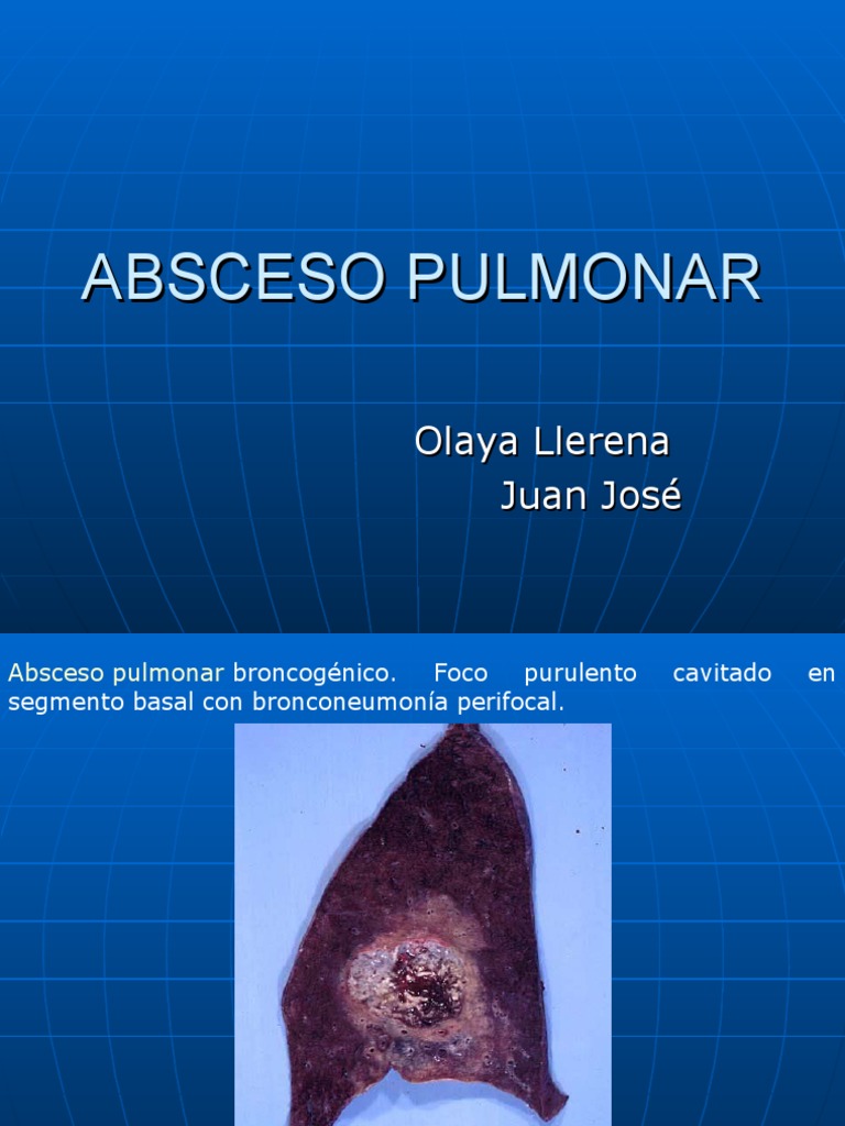 Absceso Pulmonar | PDF | Pulmón | Enfermedades y trastornos