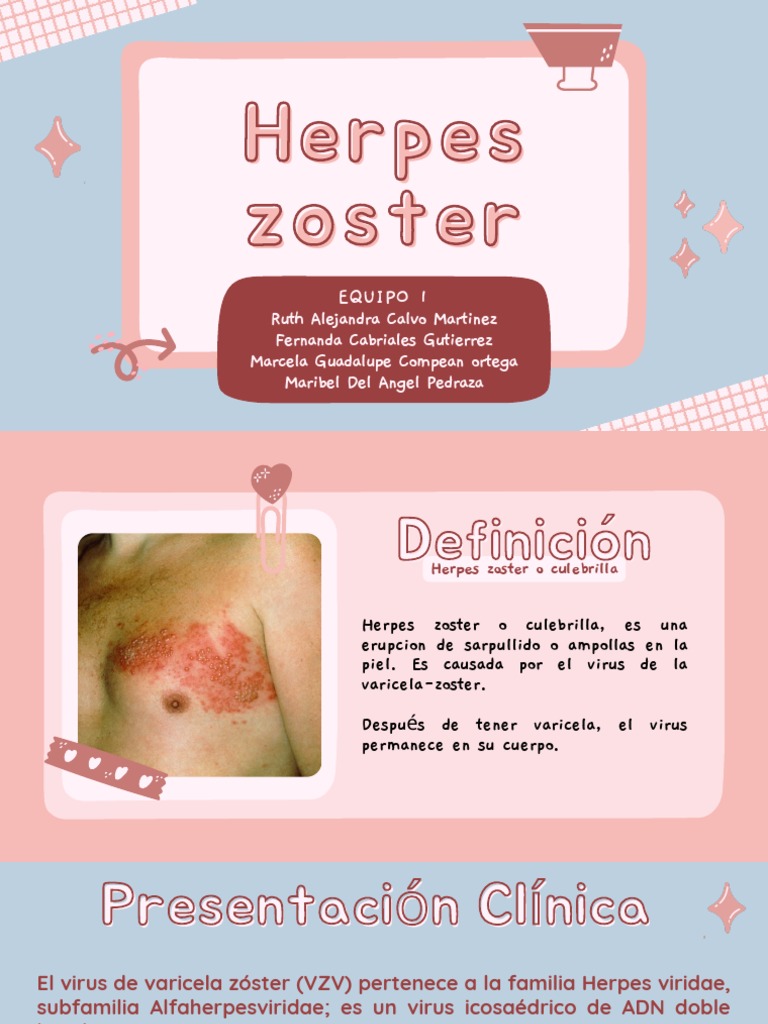 Herpes Zoster | PDF | Inmunología | Ciencias de la Salud