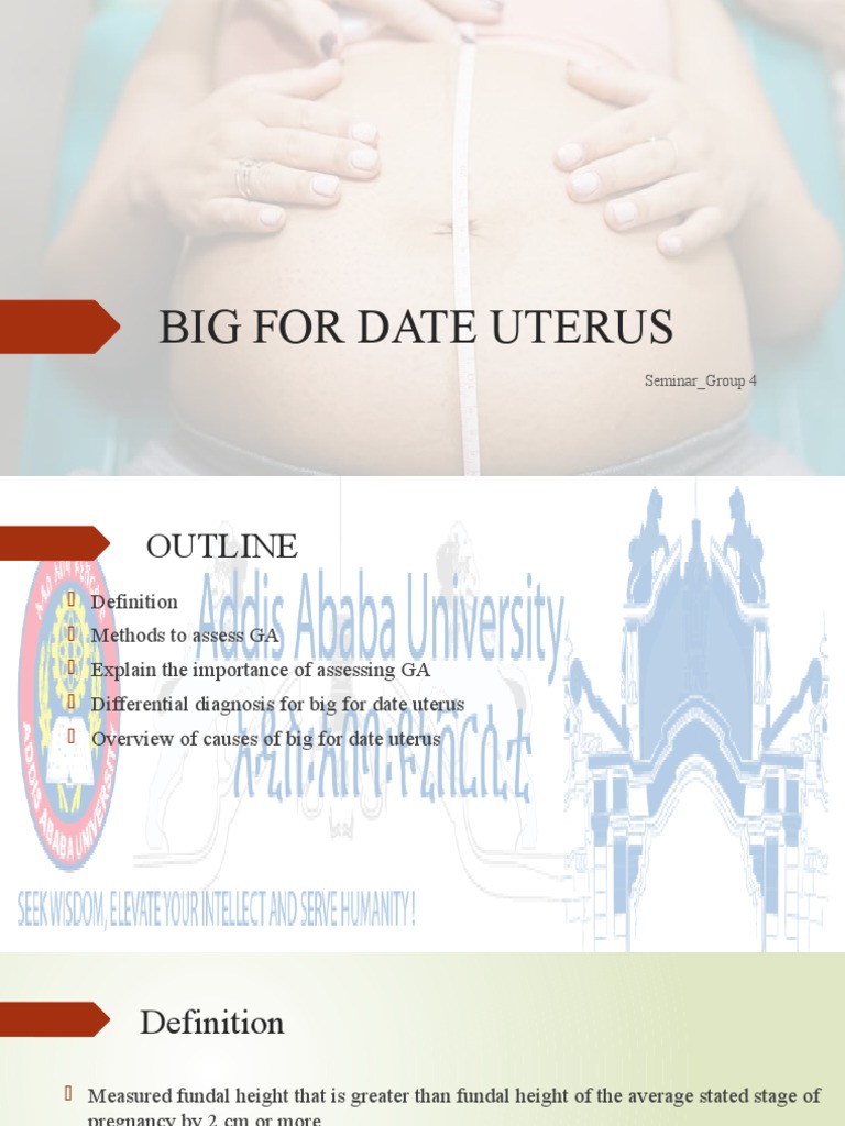 Big For Date Uterus - Seminar | PDF | Pregnancy | Childbirth