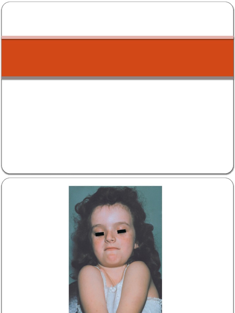 Cherubism | PDF