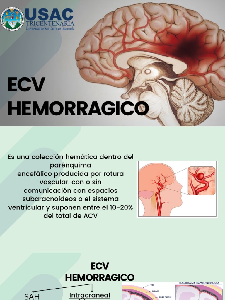 Ecv Hemorragico | PDF | Neurología | Fisiología