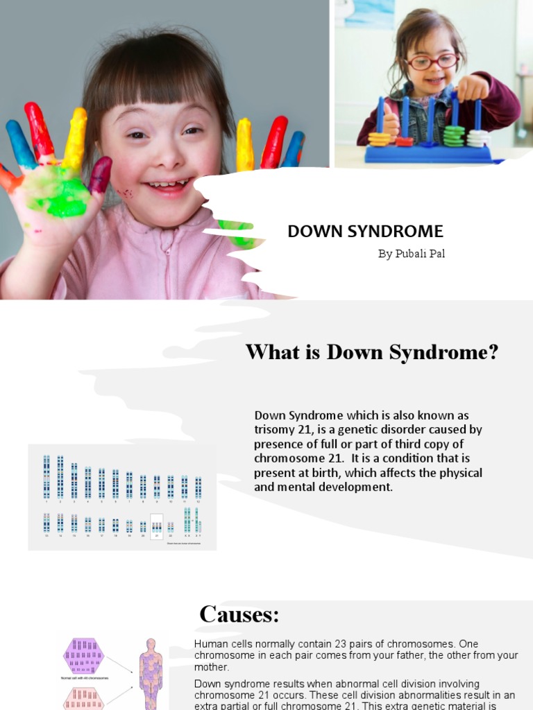 Down Syndrome | PDF