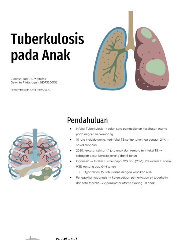 Referat TB Anak-2 | PDF