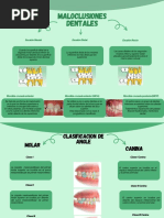 Clasificación de Angle y Maloclusiones | PDF | Boca | Diente