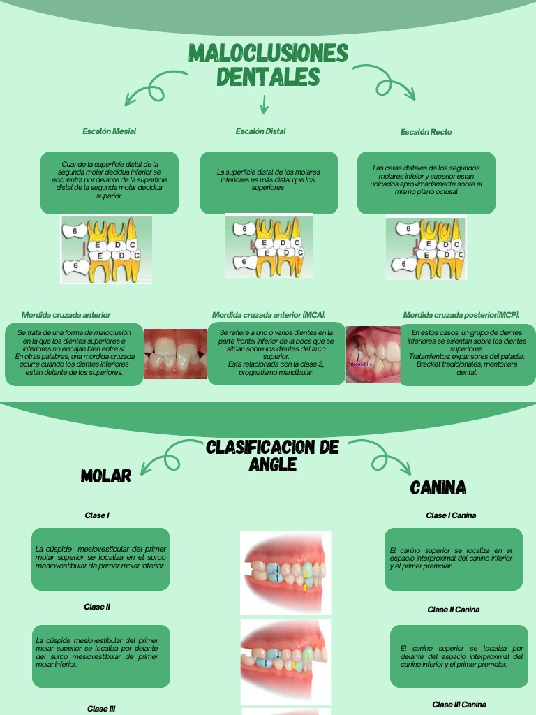 Maloclusiones de Angle | PDF | Diente | Anatomia animal