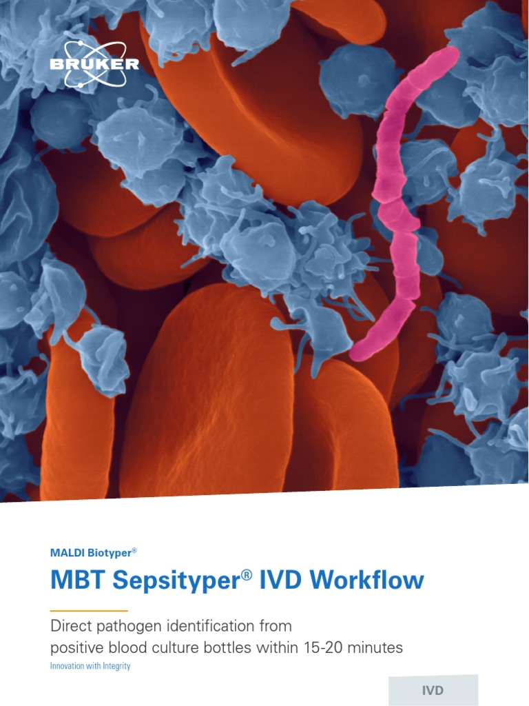 Read More About MBT Sepsityper IVD Workflow 1682516329 | Download Free PDF | Antimicrobial ...