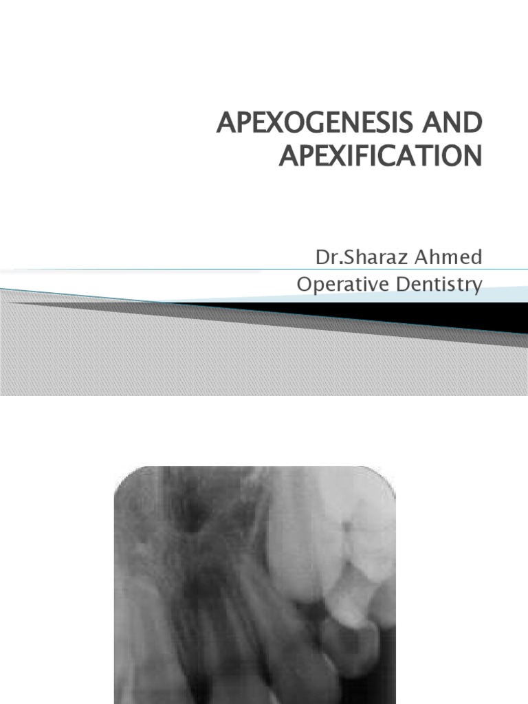 Apexification and Apexogenesis | PDF