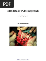 Step-by-Step FESS Surgical Guide | PDF | Human Nose | Human Head And Neck