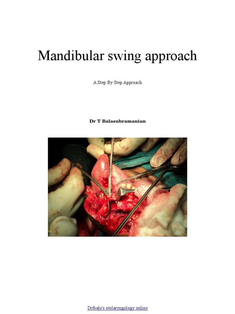 Mandibular Swing Approach Overview | PDF | Surgery | Human Anatomy