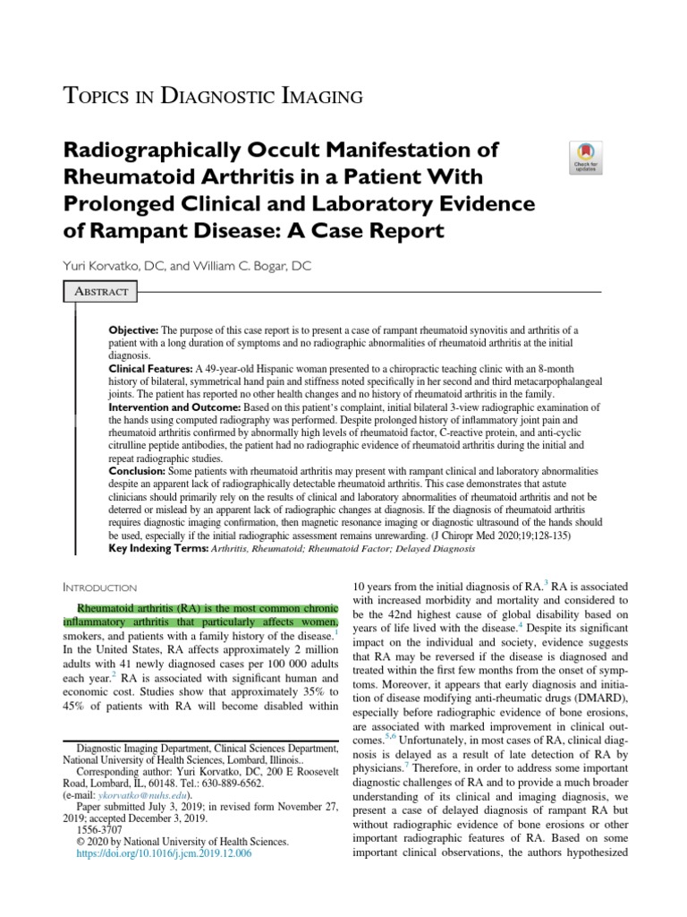 Rheumatoid Arthirits (Case Report) | PDF | Rheumatoid Arthritis | Arthritis