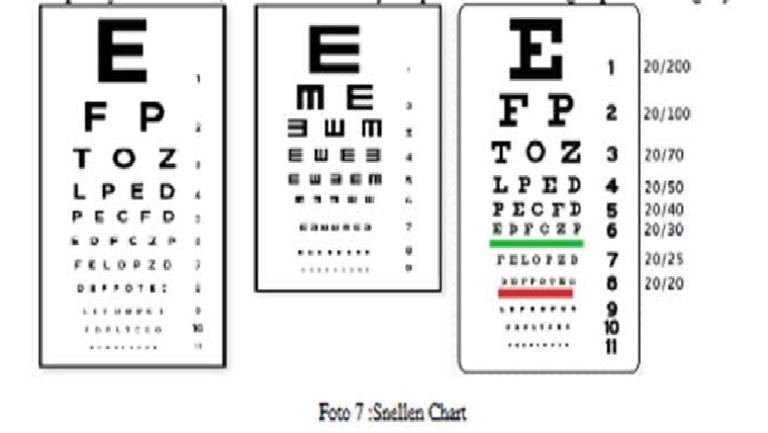 Snnellen Chart | PDF
