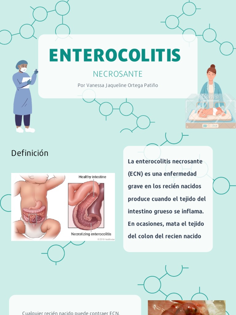 Enterocolitis necrosante | PDF