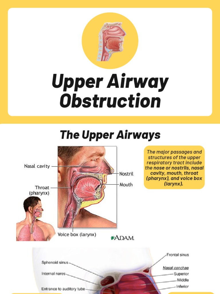 Upper Airway Obstruction | PDF