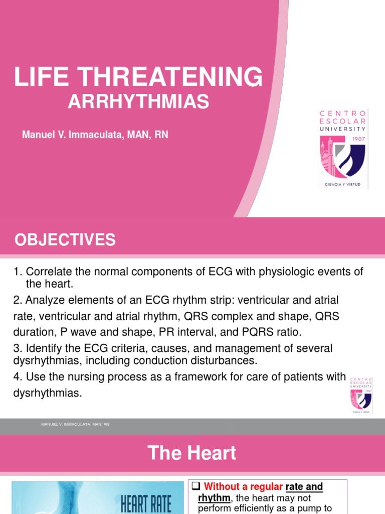 NCM 118 LECTURE LIFE THREATENING ARRHYTHMIAS MVIMMACULATA For CEU ...