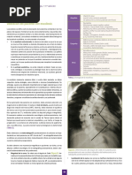 Test de Adams | PDF | Escoliosis | Especialidades Medicas