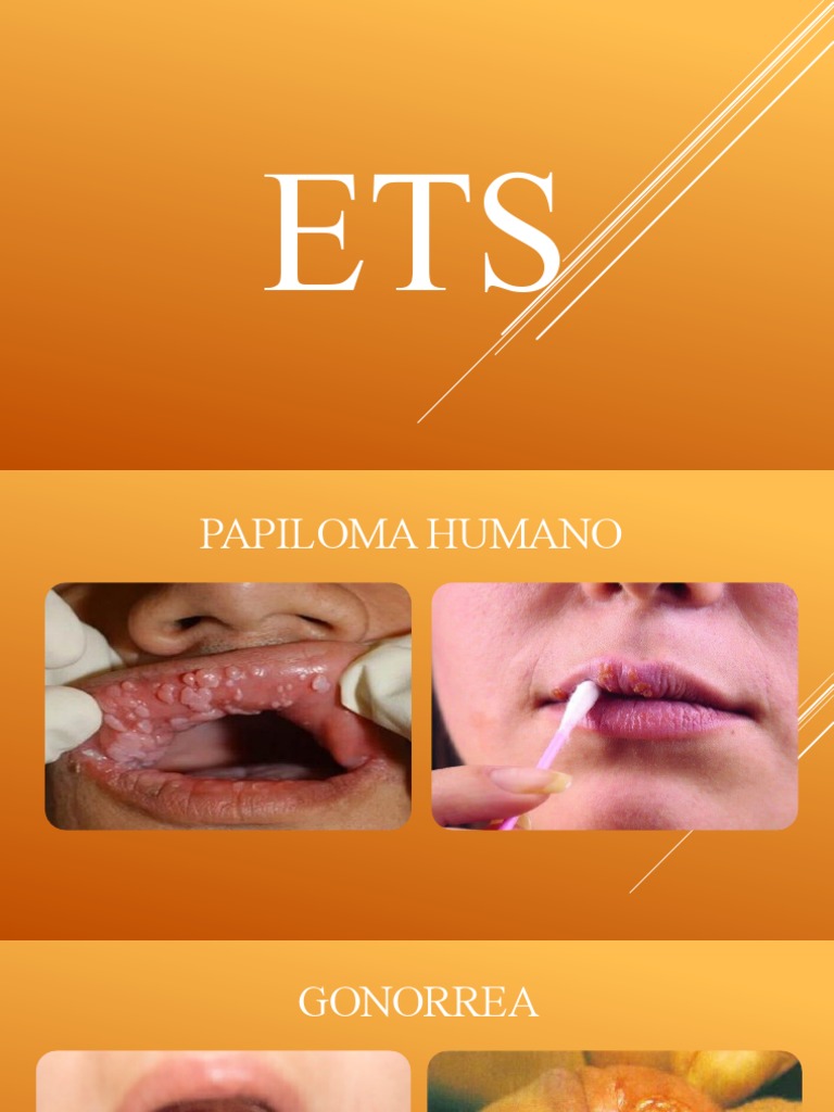 ETS | PDF