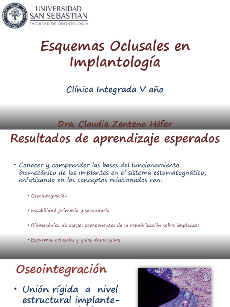 Esquemas Oclusales en ImplantologiÌ a | PDF