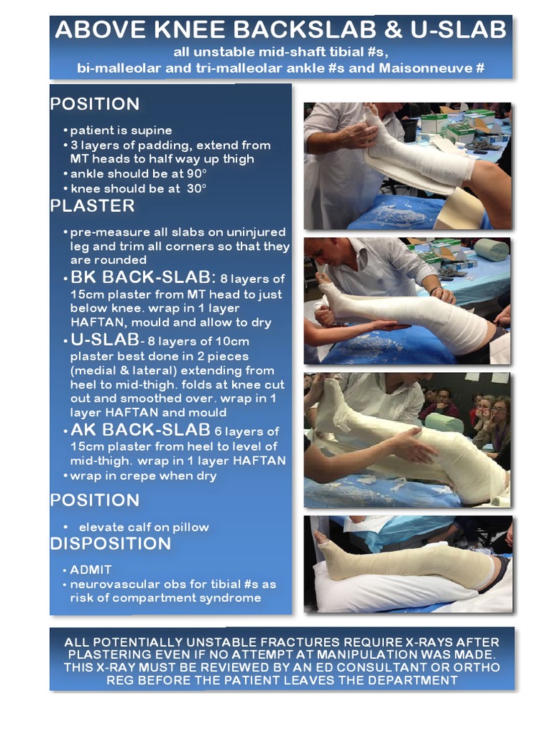 Ak Back Slab U Slab | PDF