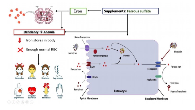 Concept Map - Iron Deficiency Anemia | PDF