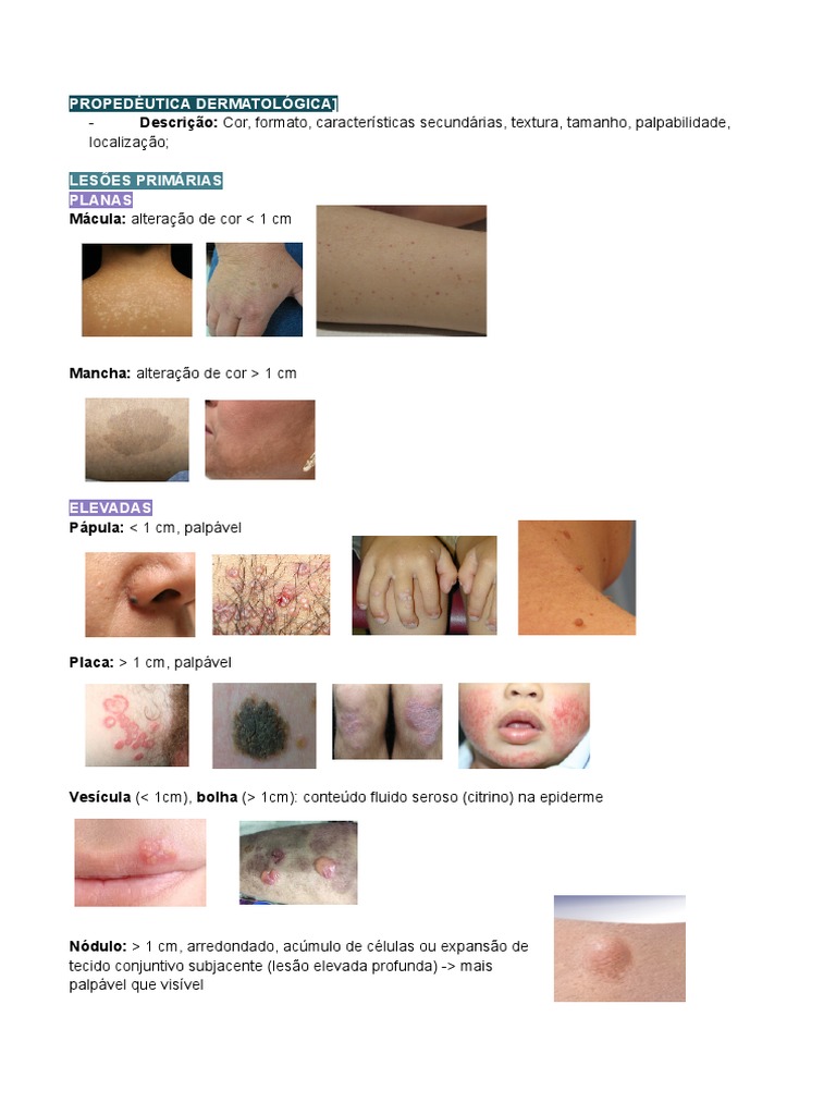 Propedêutica Dermatológica - Clínica | PDF