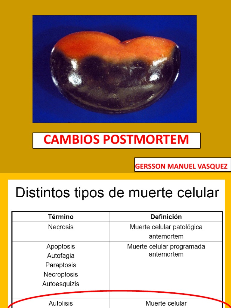 Cambios POSTMORTEM 2 | PDF | Bilis | Descomposición