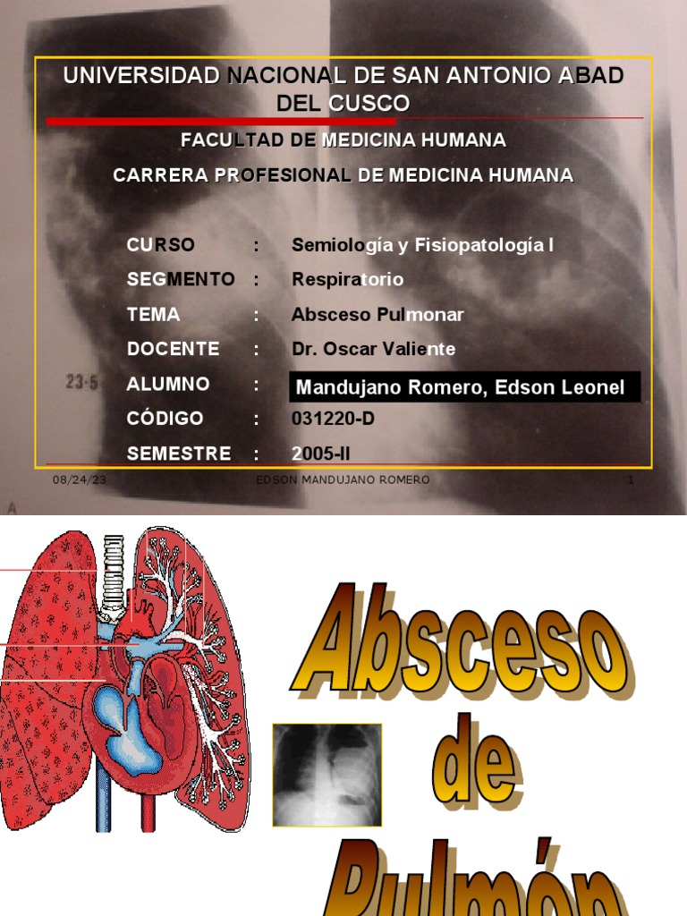 Absceso Pulmonar | PDF | Tos | Pulmón