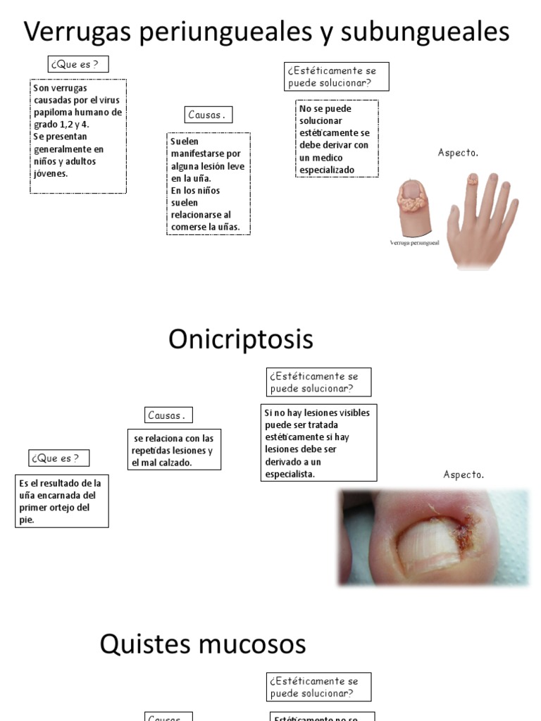 Patologías Ungueales: Causas y Soluciones | PDF | Clavo (anatomía ...