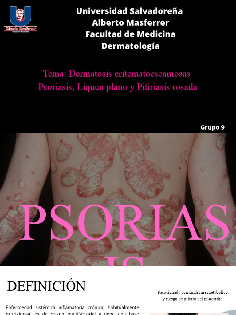Psoriasis | PDF