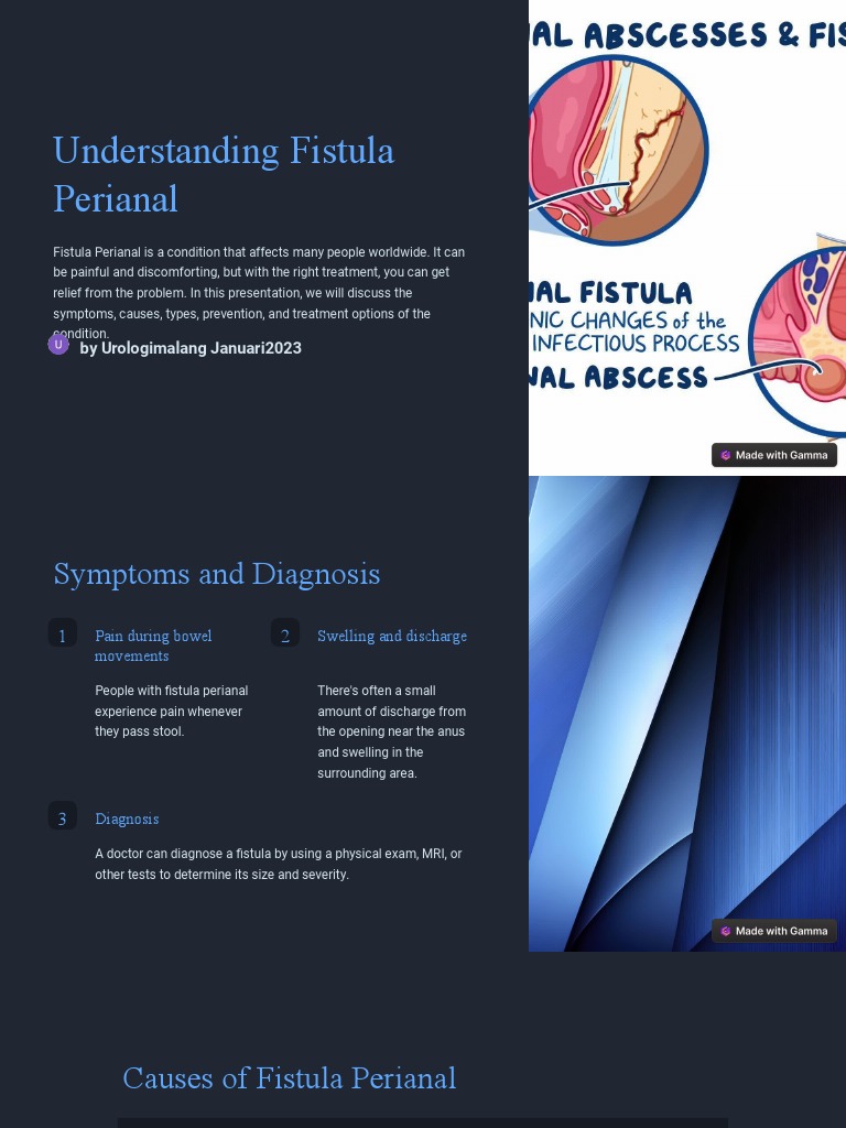 Understanding Fistula Perianal | PDF Understanding Fistula Perianal | PDF
