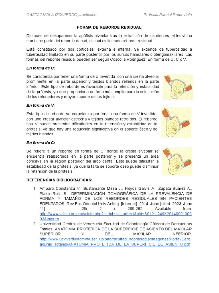 Forma de Reborde Residual - PPR | PDF | Dentadura postiza | Ramas de ...
