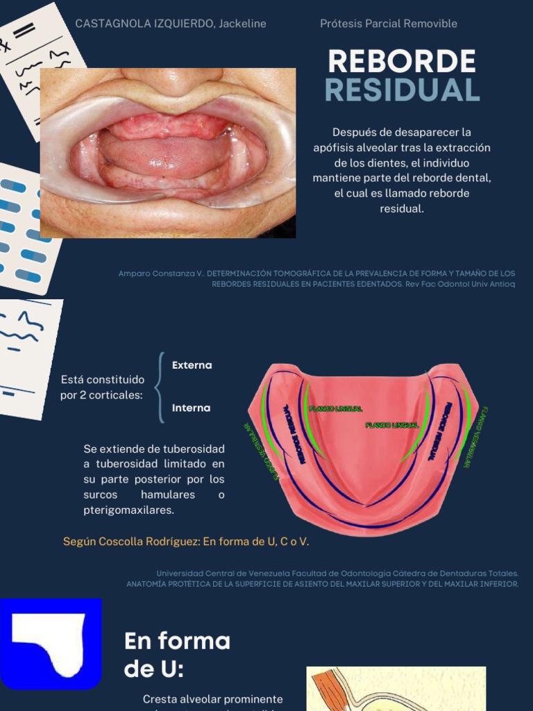 Diapositivas FORMA DE REBORDE RESIDUAL - PPR | PDF | Dentadura postiza | Odontología