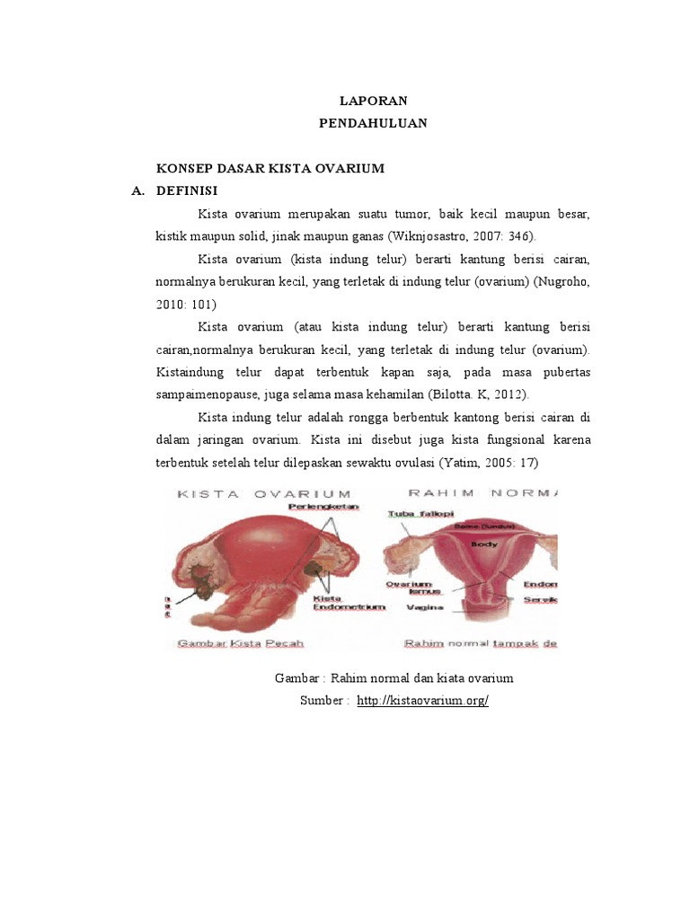LP Kista Ovarium | PDF | Ilmu Sosial | Kesehatan Holistik