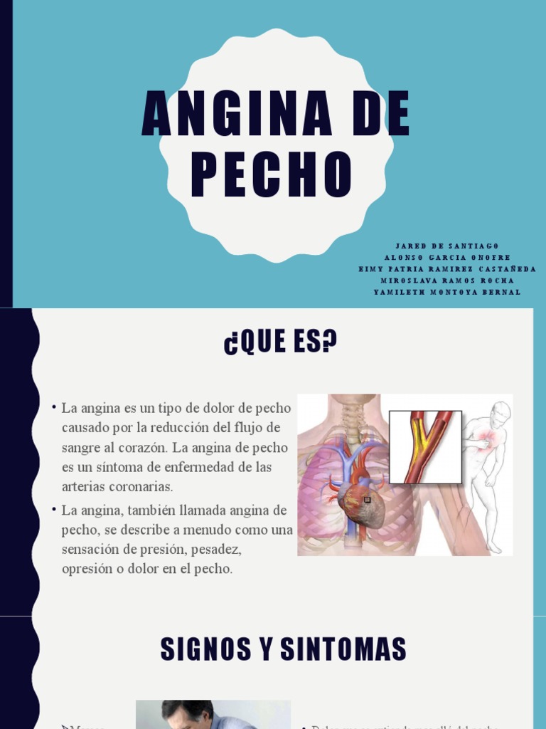 Angina de Pecho: Síntomas y Tratamiento | PDF | Corazón | Infarto de ...