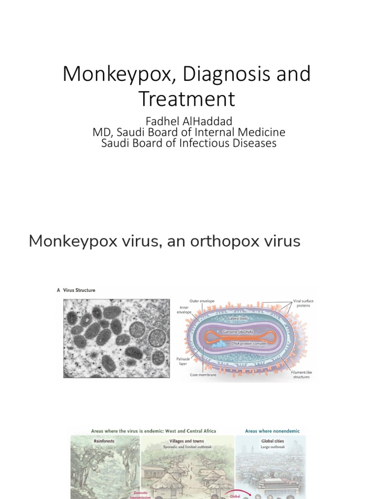 Monkeypox, Diagnosis and Treatment | PDF | Virus | Infection