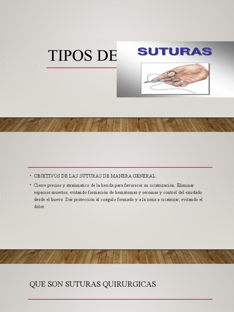 Tipos de Sutura | Descargar gratis PDF | Sutura Quirúrgica | Herida