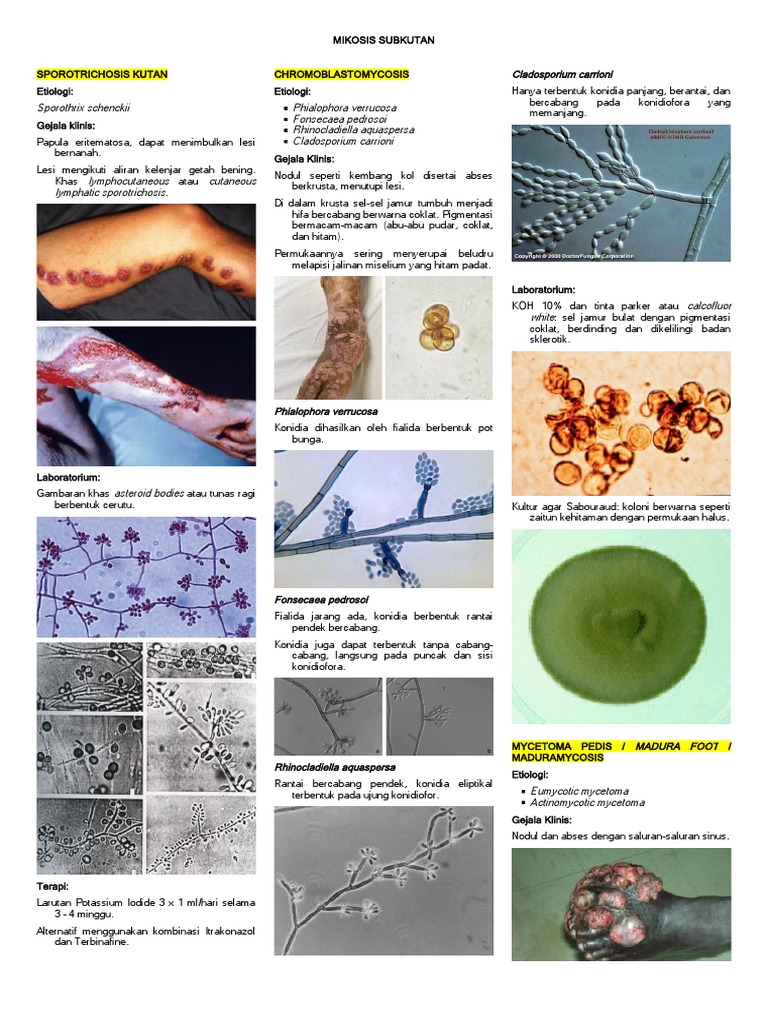 Mikosis Subkutan: Jenis dan Terapi | PDF