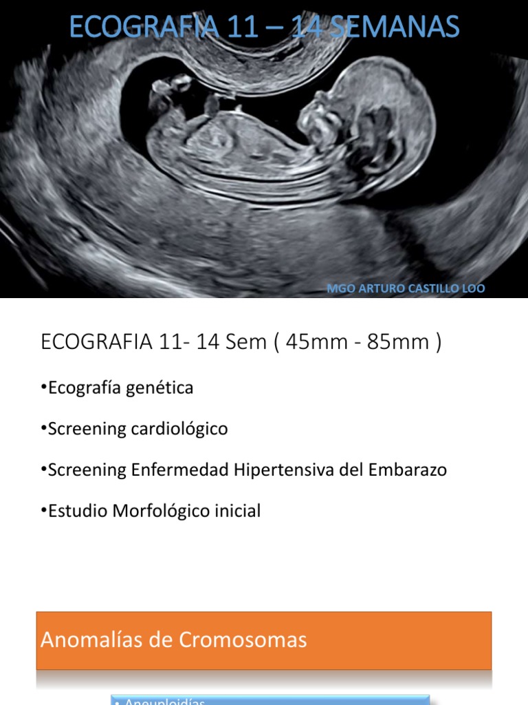 Ecografia 11 A 14 Semanas | PDF