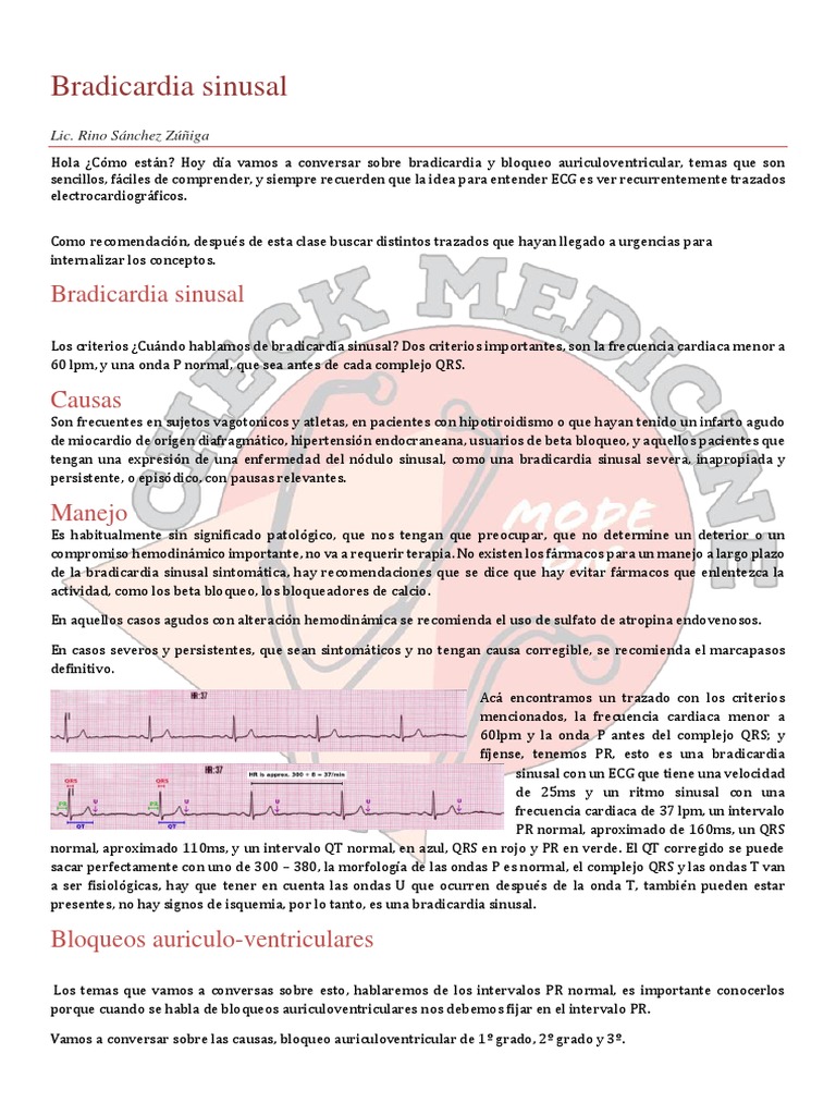 Bradicardia Sinusal Actulizado | PDF | Electrocardiografia ...