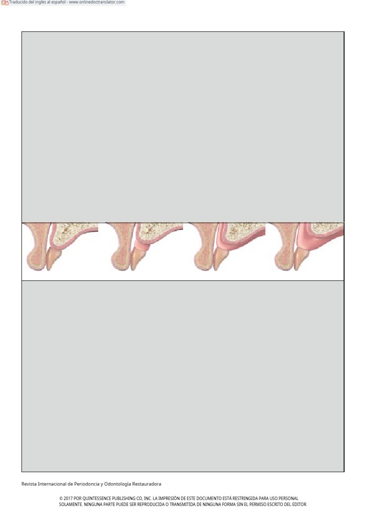 Clasificación Lip-Tooth-Ridge .En - Es | PDF