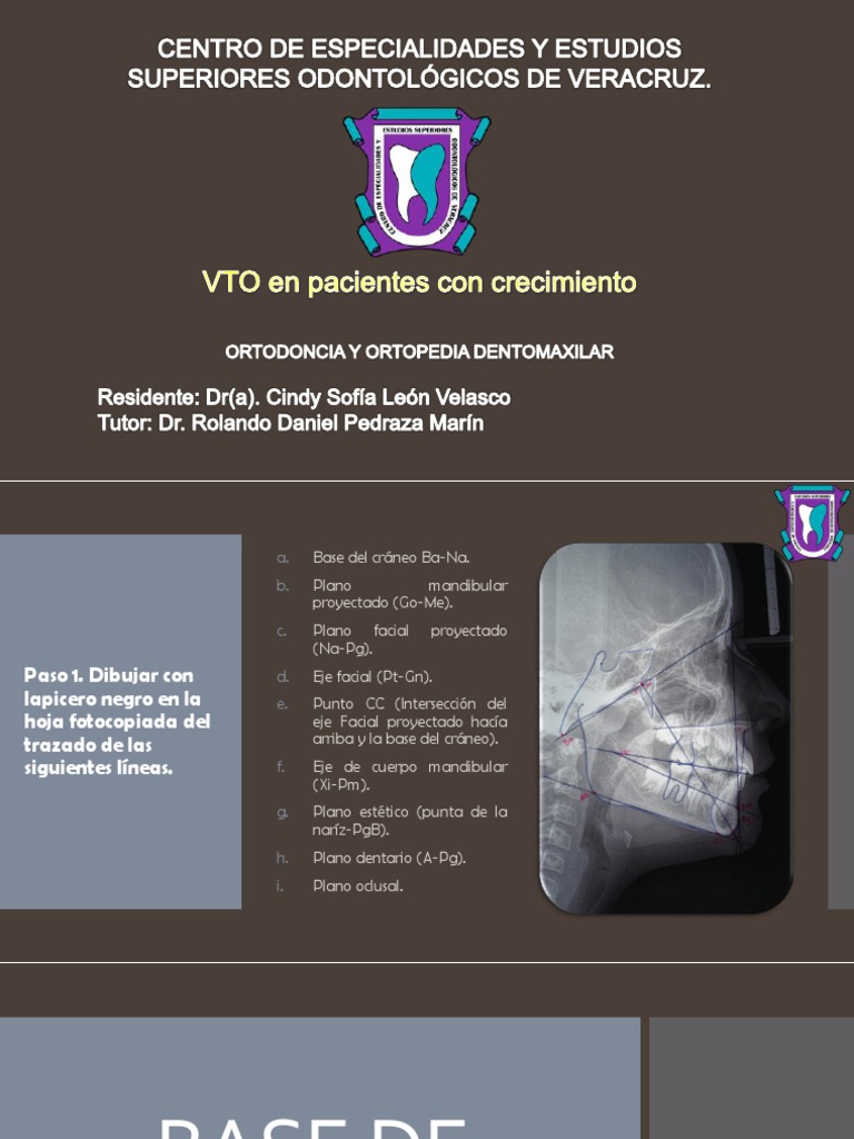 VTO | PDF | Cráneo