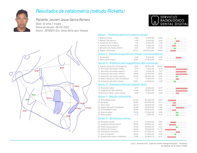 Cefalometria Lateral Ricketts Pdf