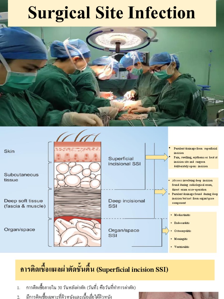 SSI อบรม | PDF