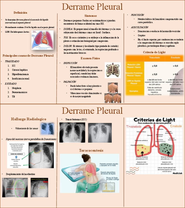 Derrame Pleural | PDF