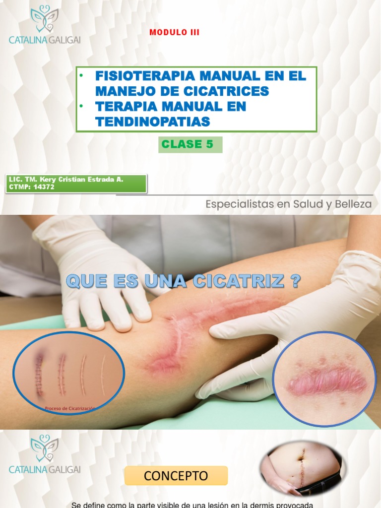 Manejo de Cicatrices en Fisioterapia | PDF | Cicatriz | Herida