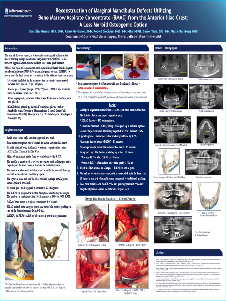 BMAC for Mandibular Reconstruction | PDF | Bone | Bone Marrow