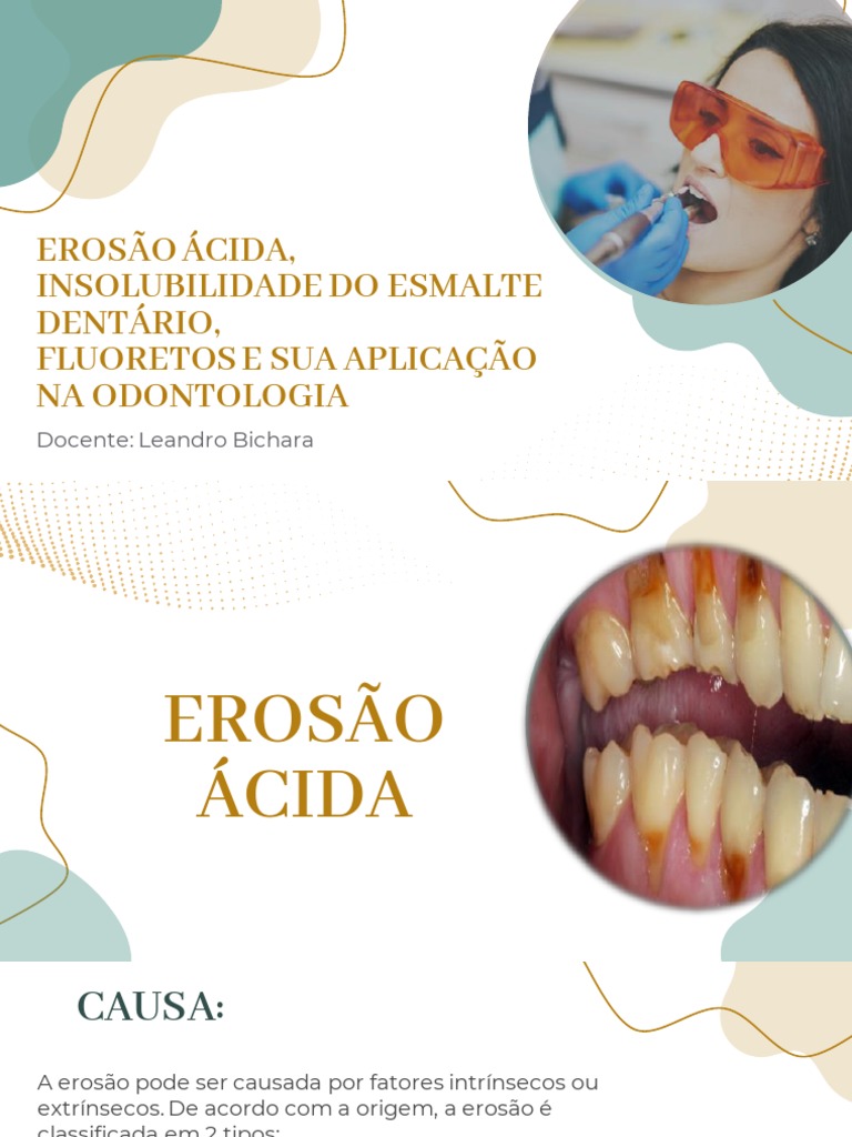 Erosão Acida | PDF | Dente | Esmalte dentário