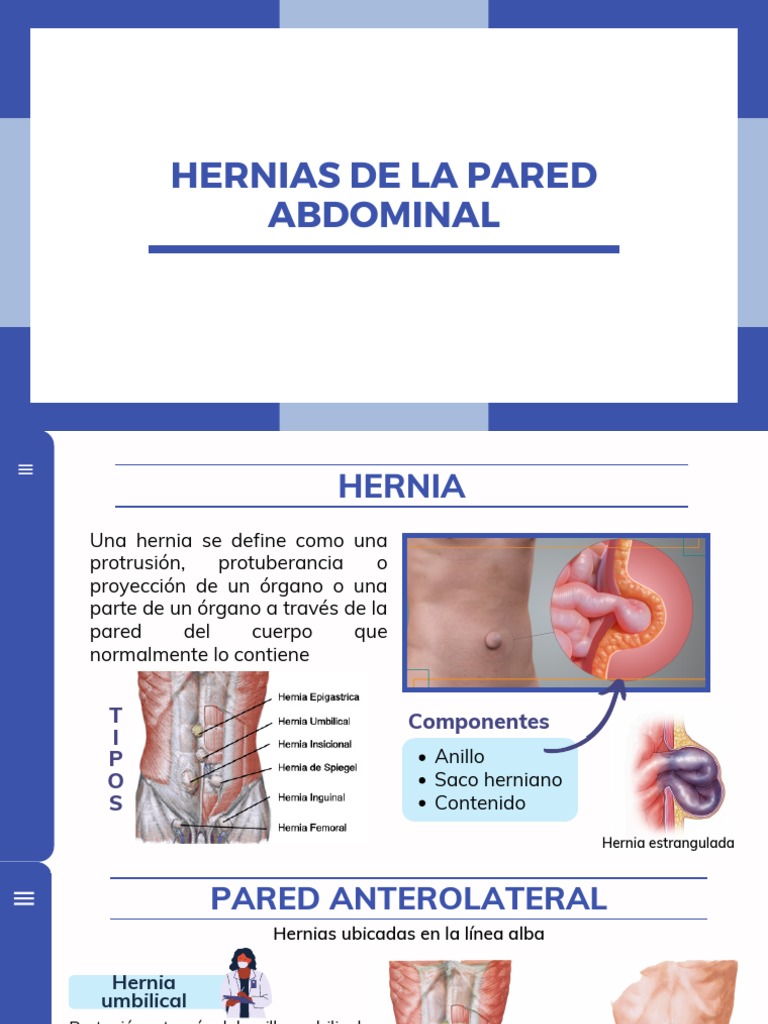 Hernias de La Pared Abdominal | PDF | Abdomen | Enfermedades y trastornos