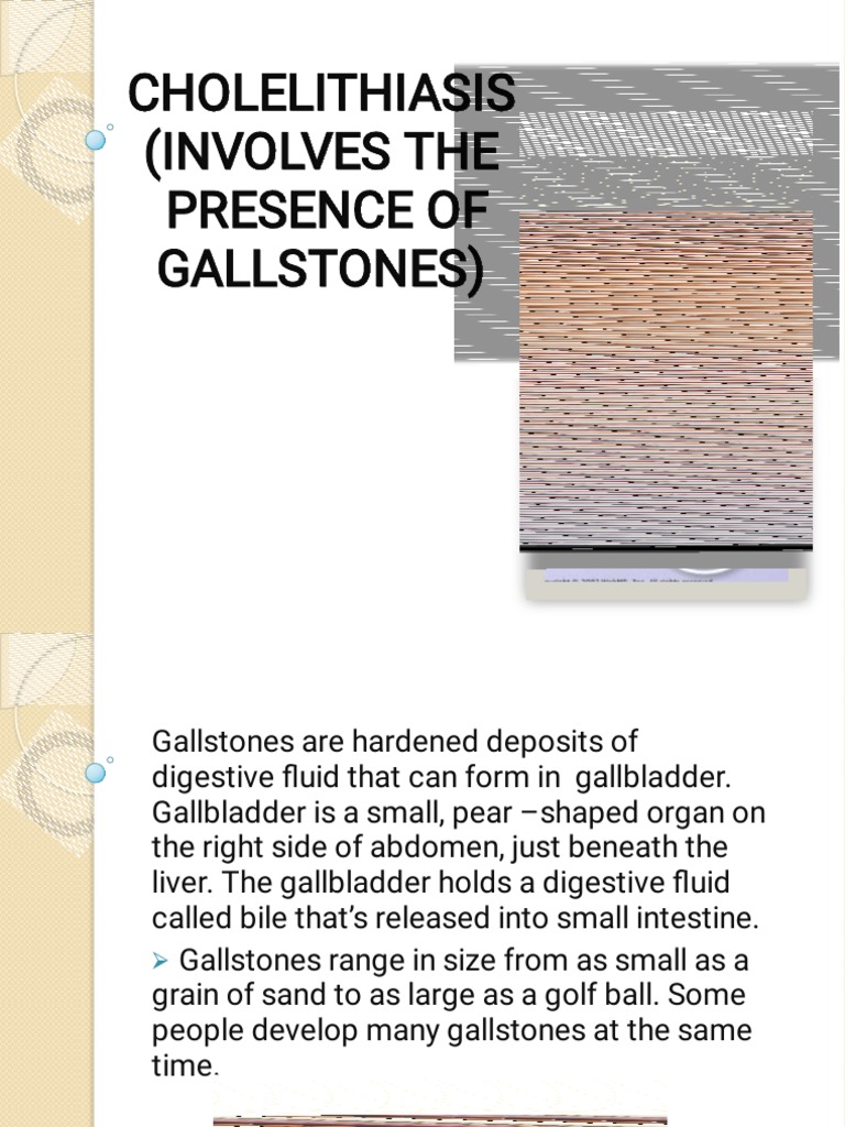 CHOLELITHIASIS Seminar-1 | PDF | Bile | Gallbladder